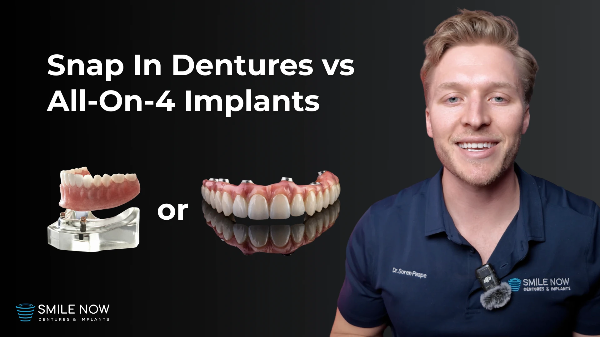 Snap In Dentures Vs Implants: Comparing 2 Popular Tooth Replacement ...